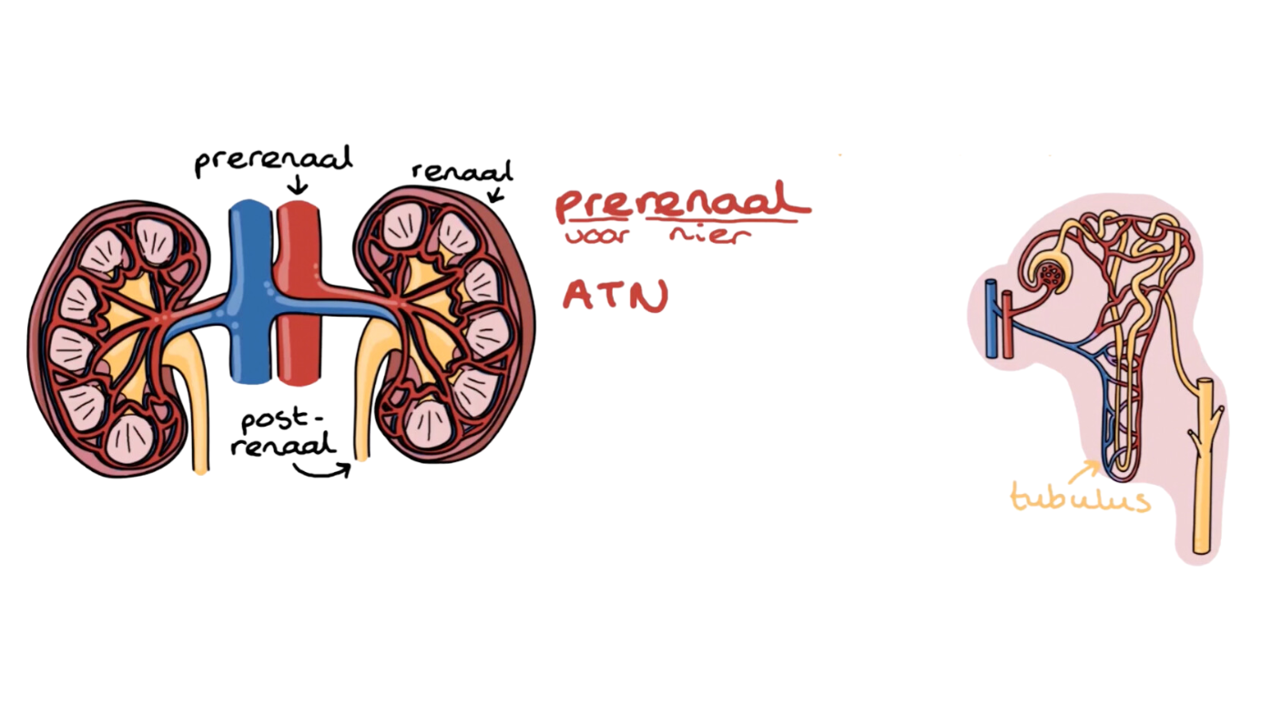 Acute nierschade – Juf Danielle